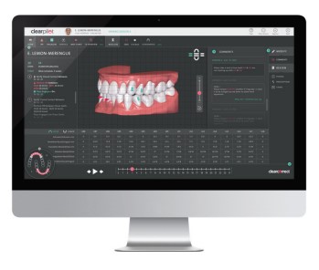 Clear Aligners That Work for | DPS